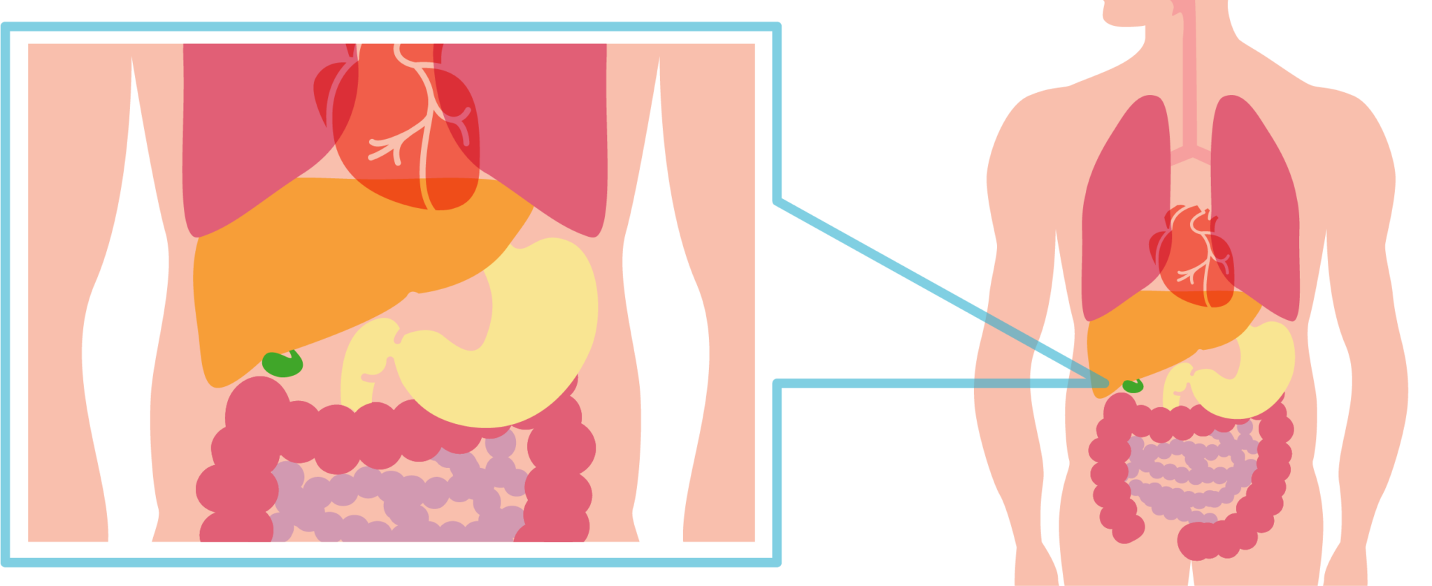 Gallbladder Surgery - Digital patient information hub