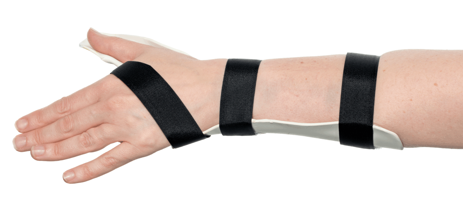 Advice and exercises following your thumb extensor tendon repair ...