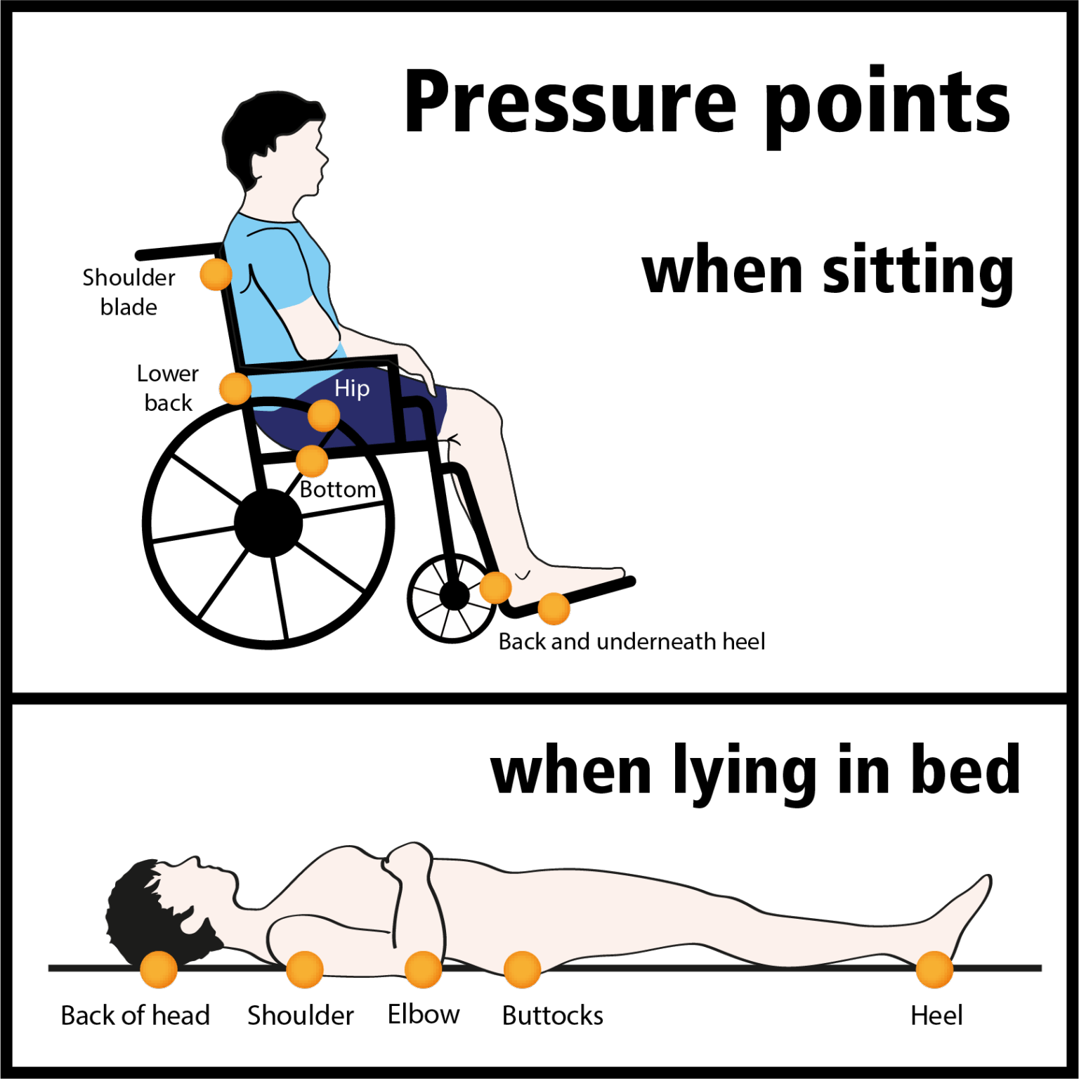 An easy read guide to pressure sores - Digital patient information hub