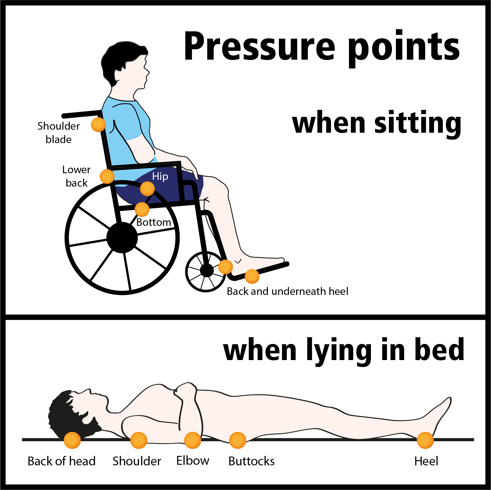 An easy read guide to pressure sores - Digital patient information hub