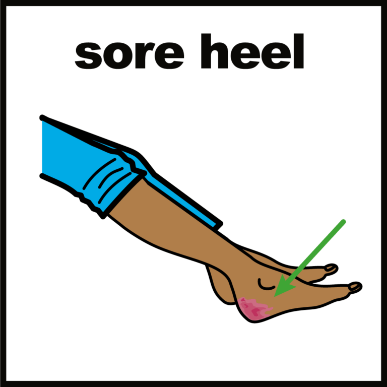 An easy read guide to pressure sores - Digital patient information hub