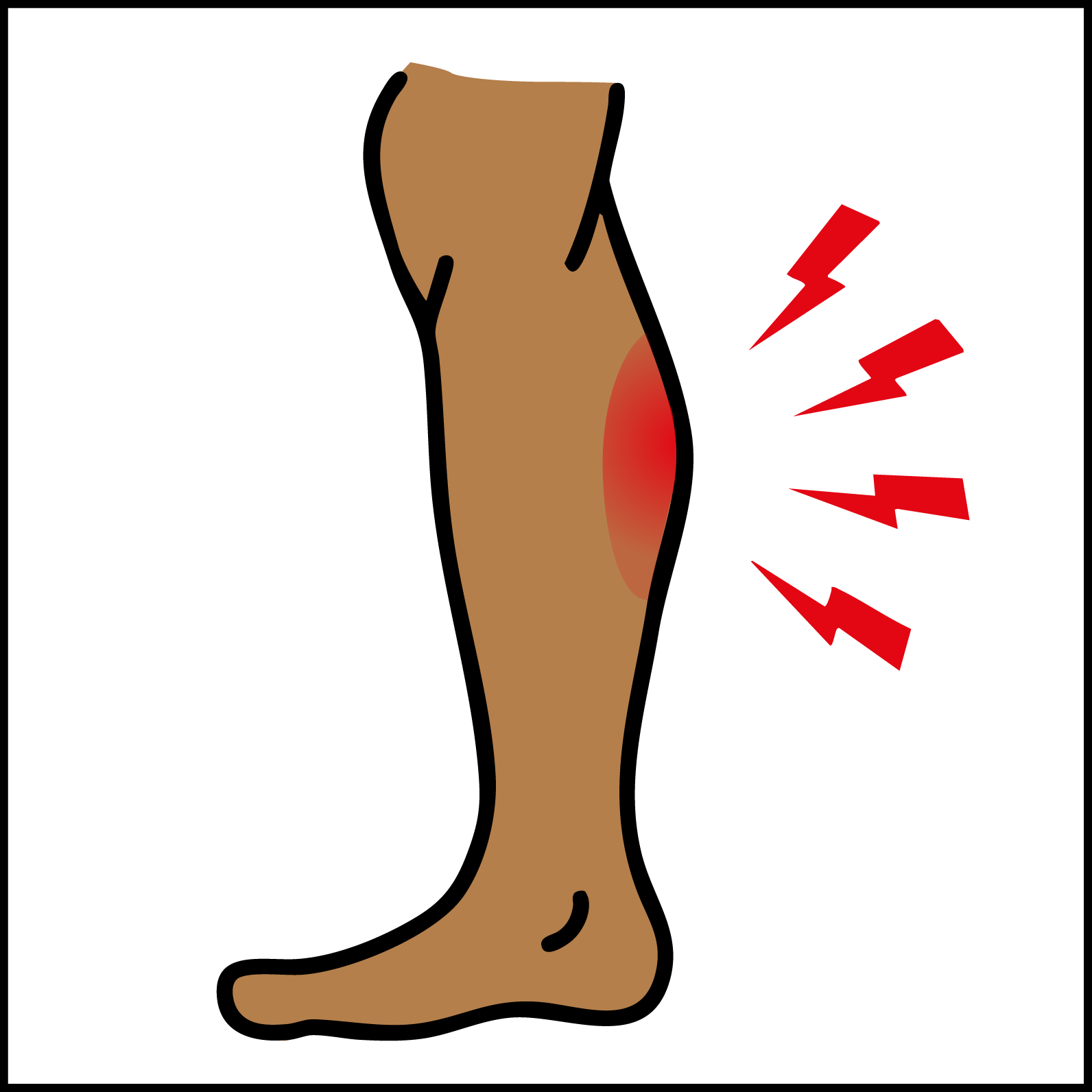An easy read guide to pressure sores - Digital patient information hub
