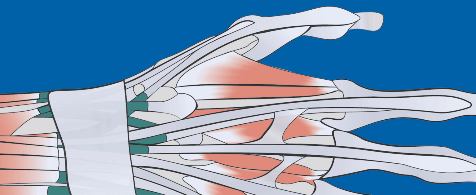 Advice and exercises following your thumb extensor tendon repair ...