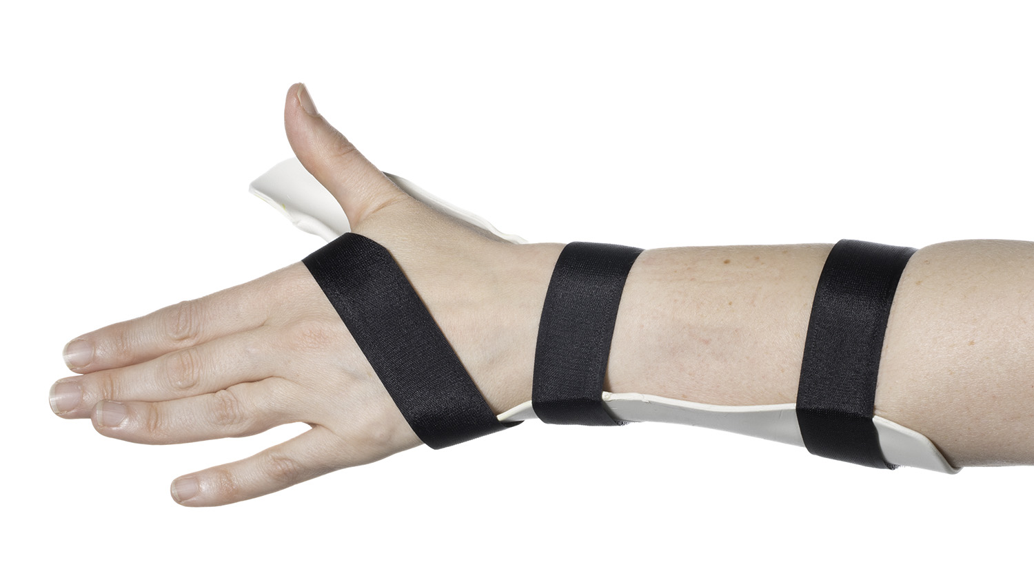 Advice and exercises following your thumb extensor tendon repair ...