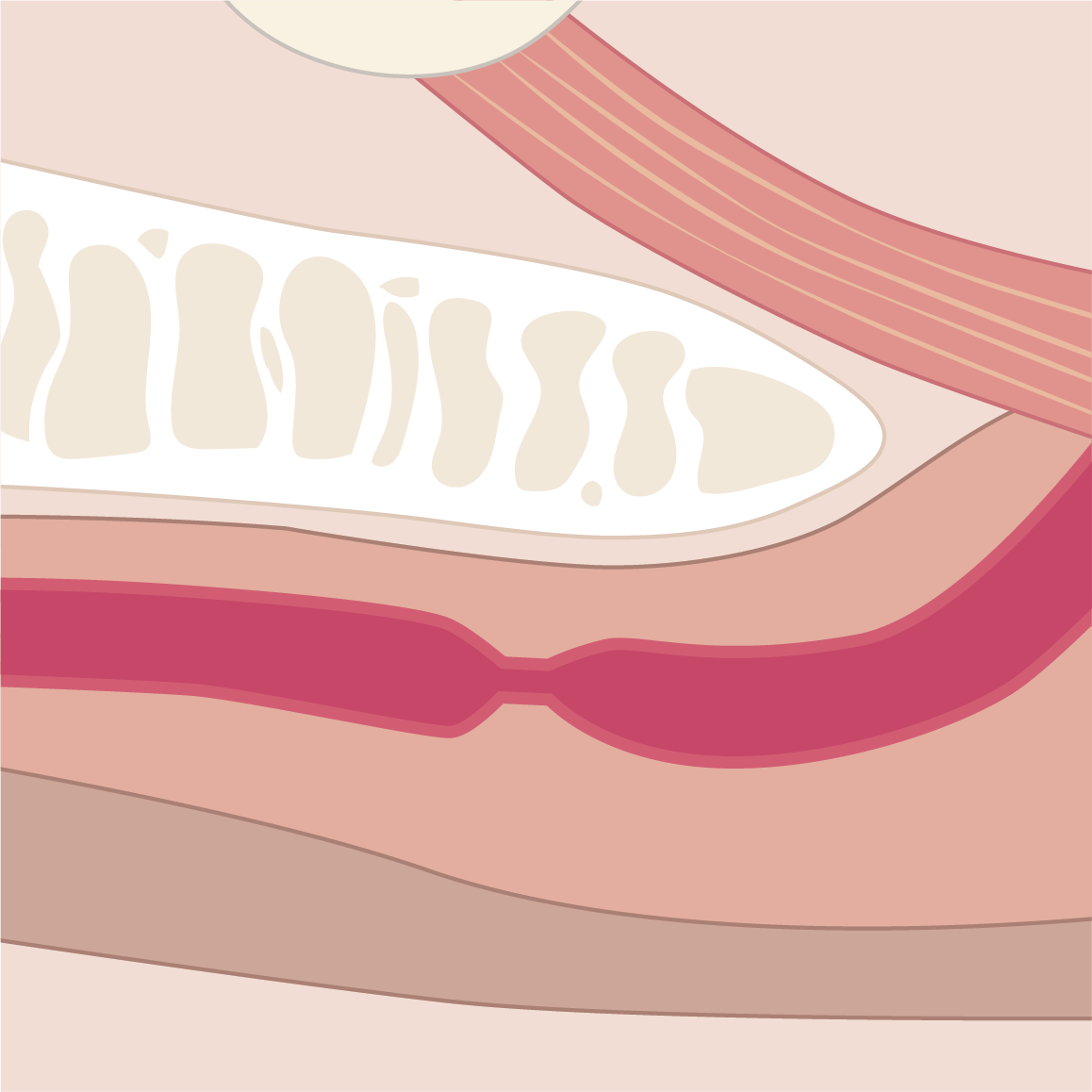 Anterior Urethral Strictures - Digital patient information hub